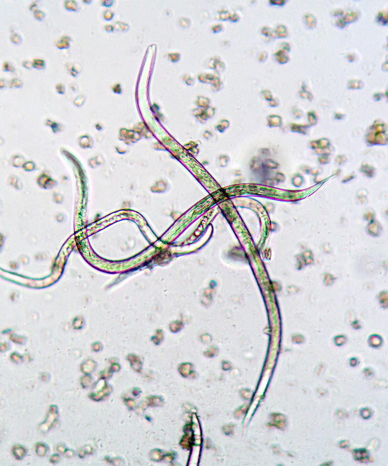 What are beneficial nematodes? Plus how to use these microscopic ...