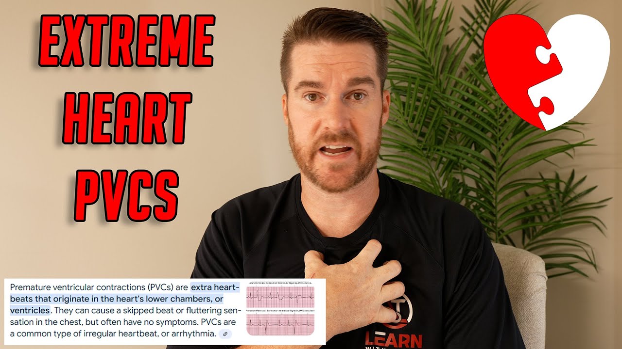 My Extreme Heart PVC Journey - Multiple Surgeries and How I Feel Now