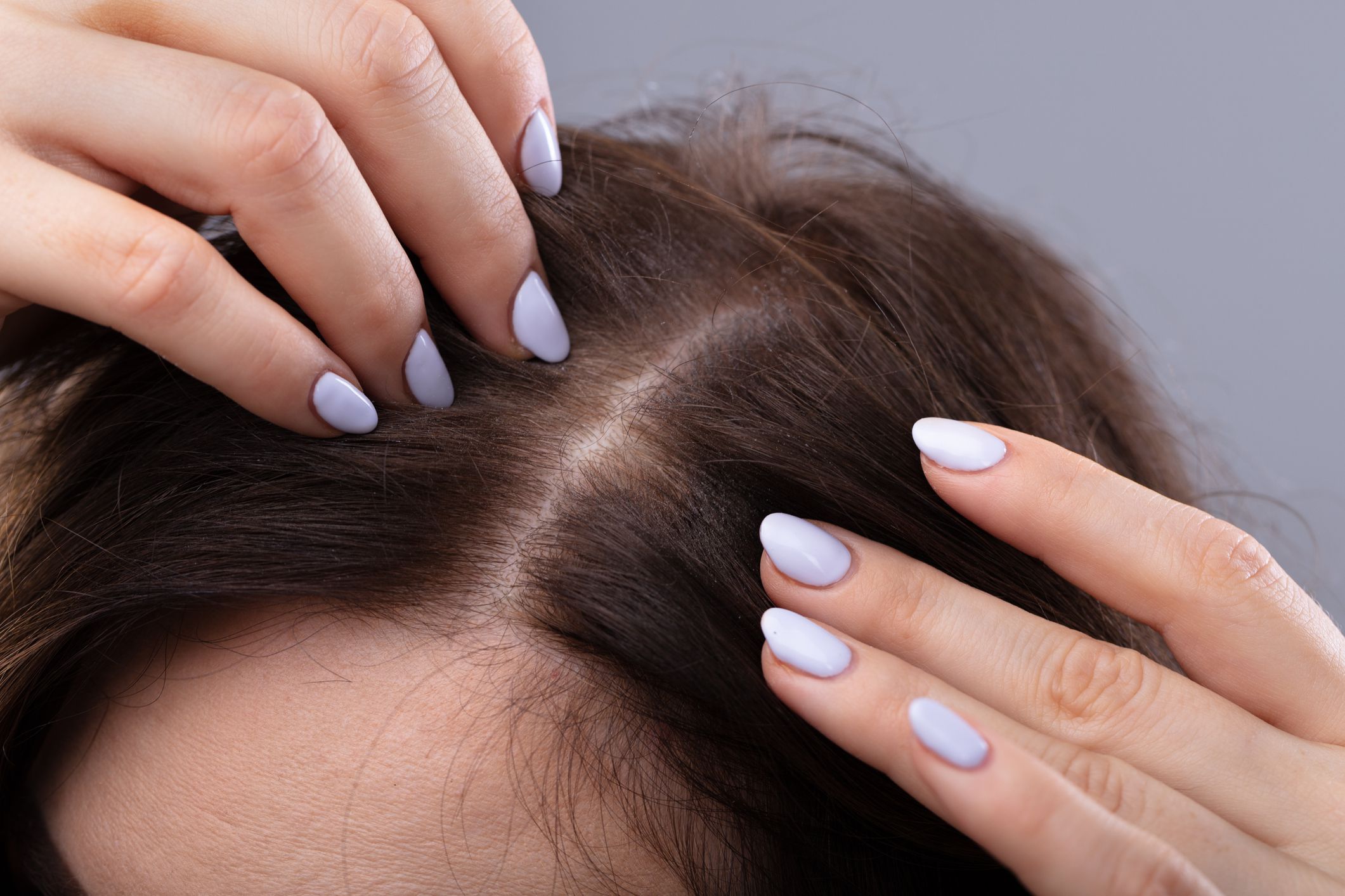 Club Hair: What Is It & How to Treat It