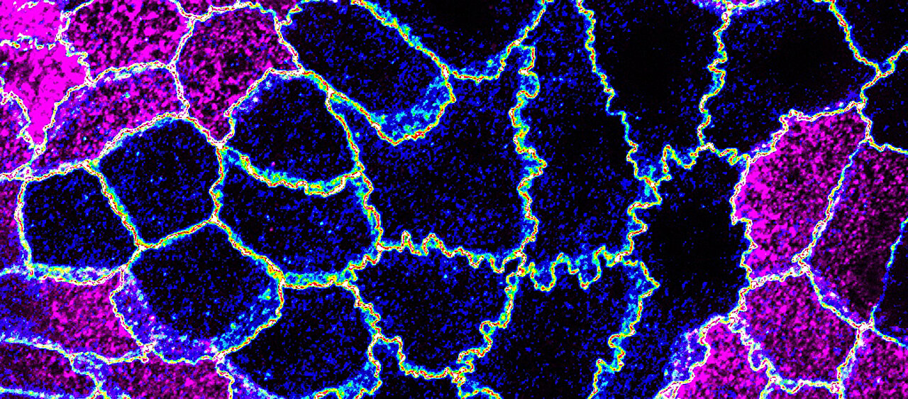 The fine control of cell mechanics: Gamma-actin protein may play ...