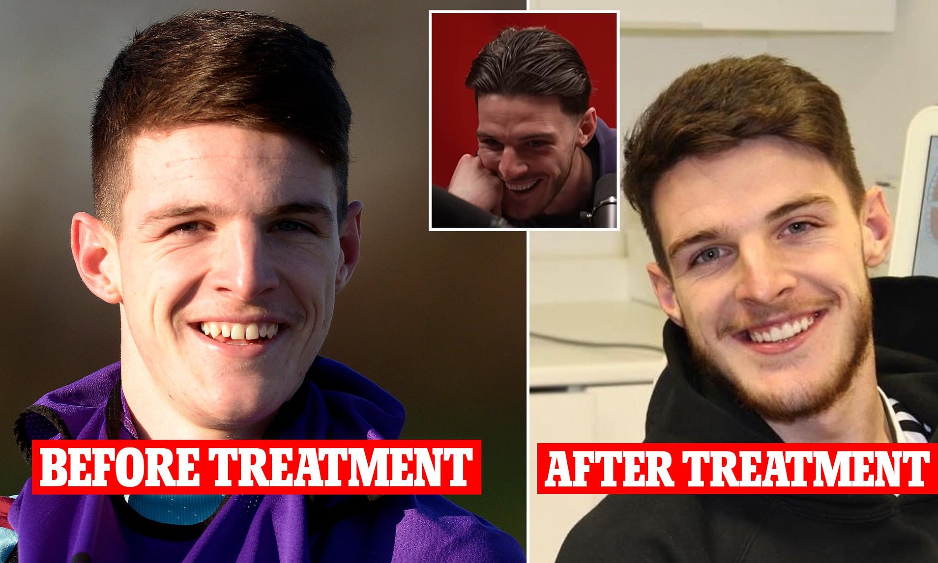 Declan Rice jokingly reveals the teeth treatment which 'saved his life ...