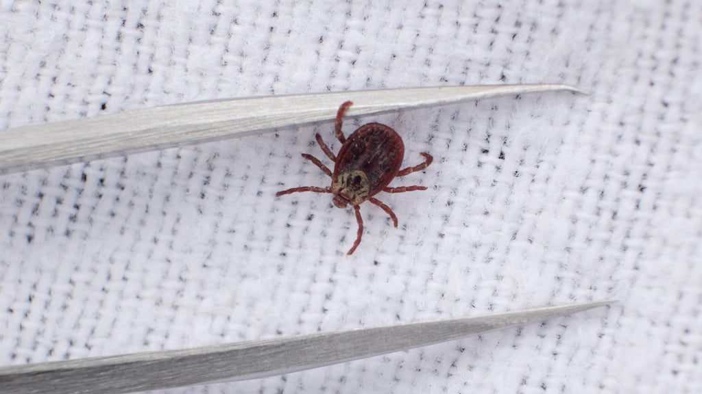 Tick season officially arrives in Massachusetts. Here's how to keep you ...