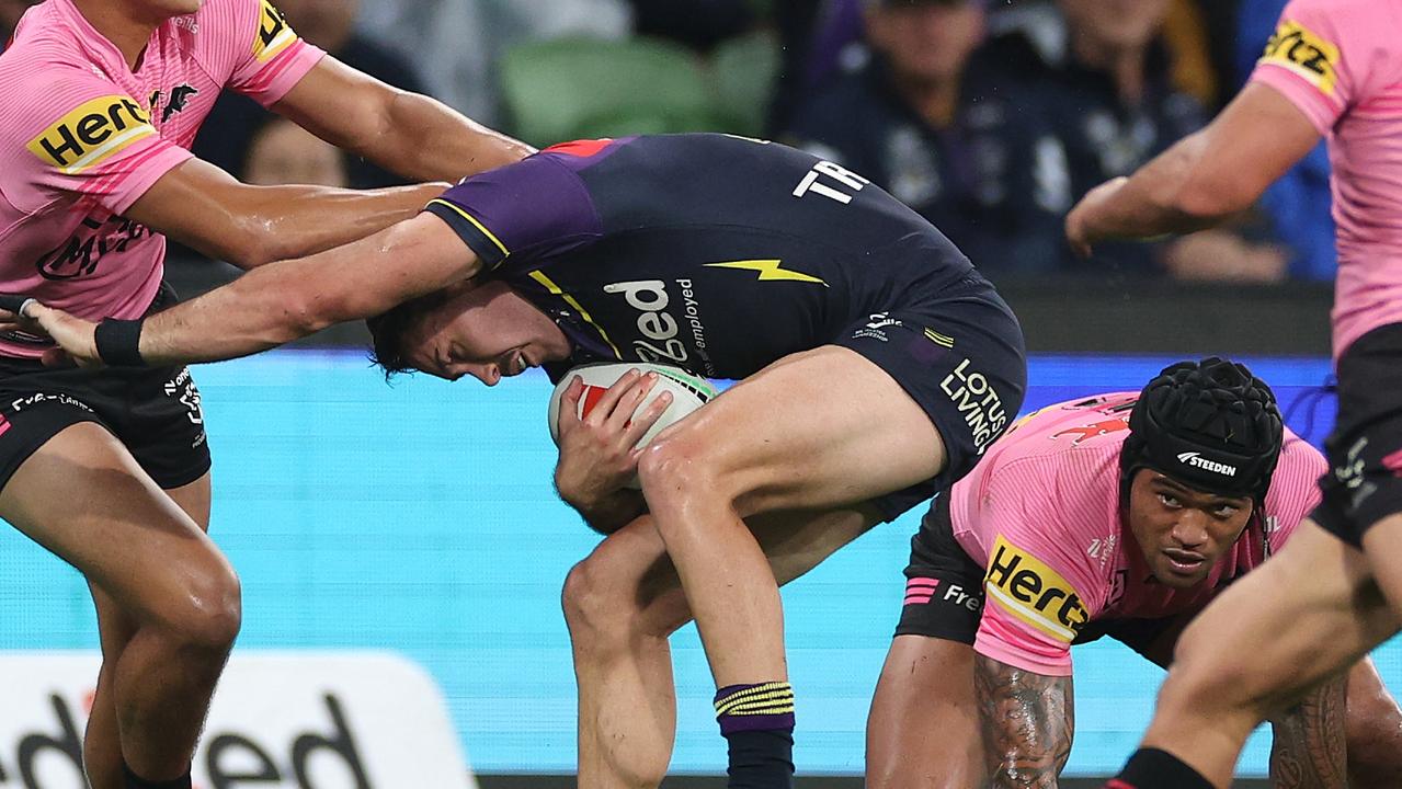 Broken hand, facial fracture hit Storm