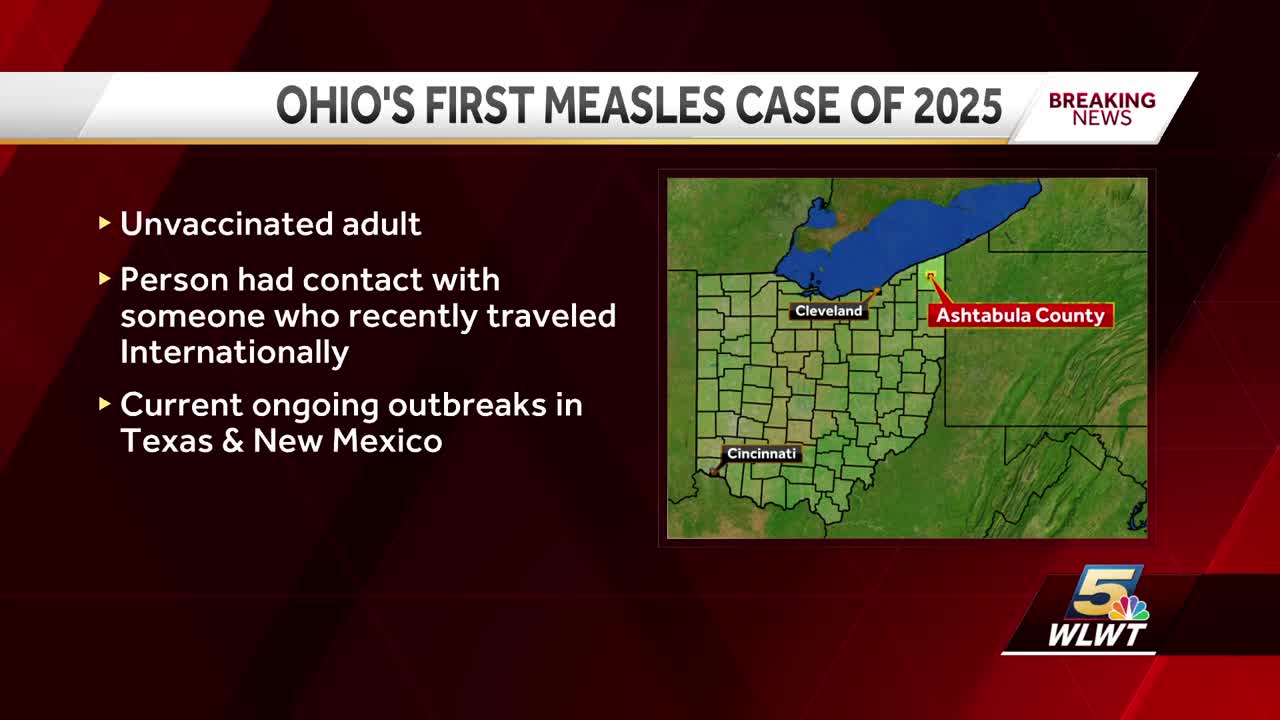 Ohio reports first measles case of 2025