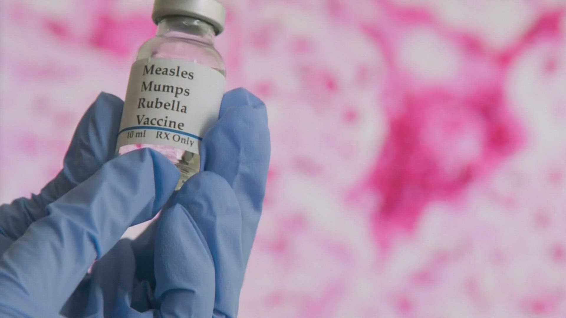 Ohio reports first measles case in adult from Ashtabula County