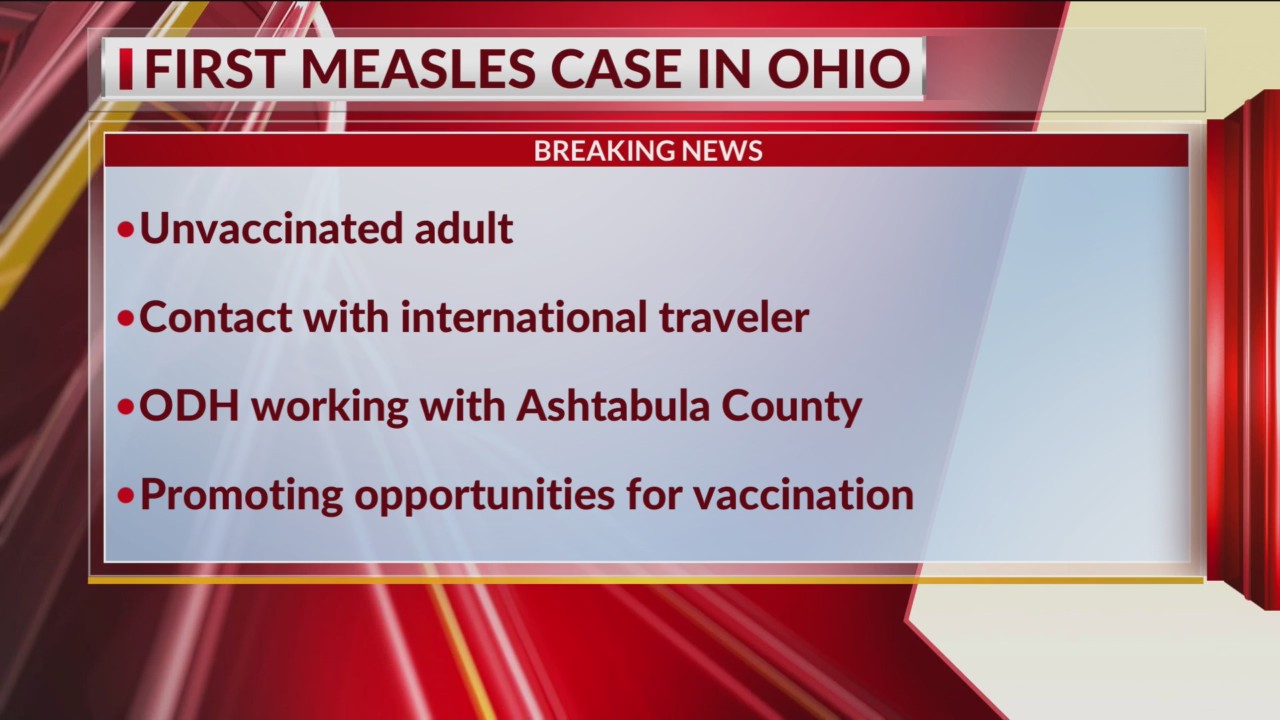 Ohio reports first measles case of 2025