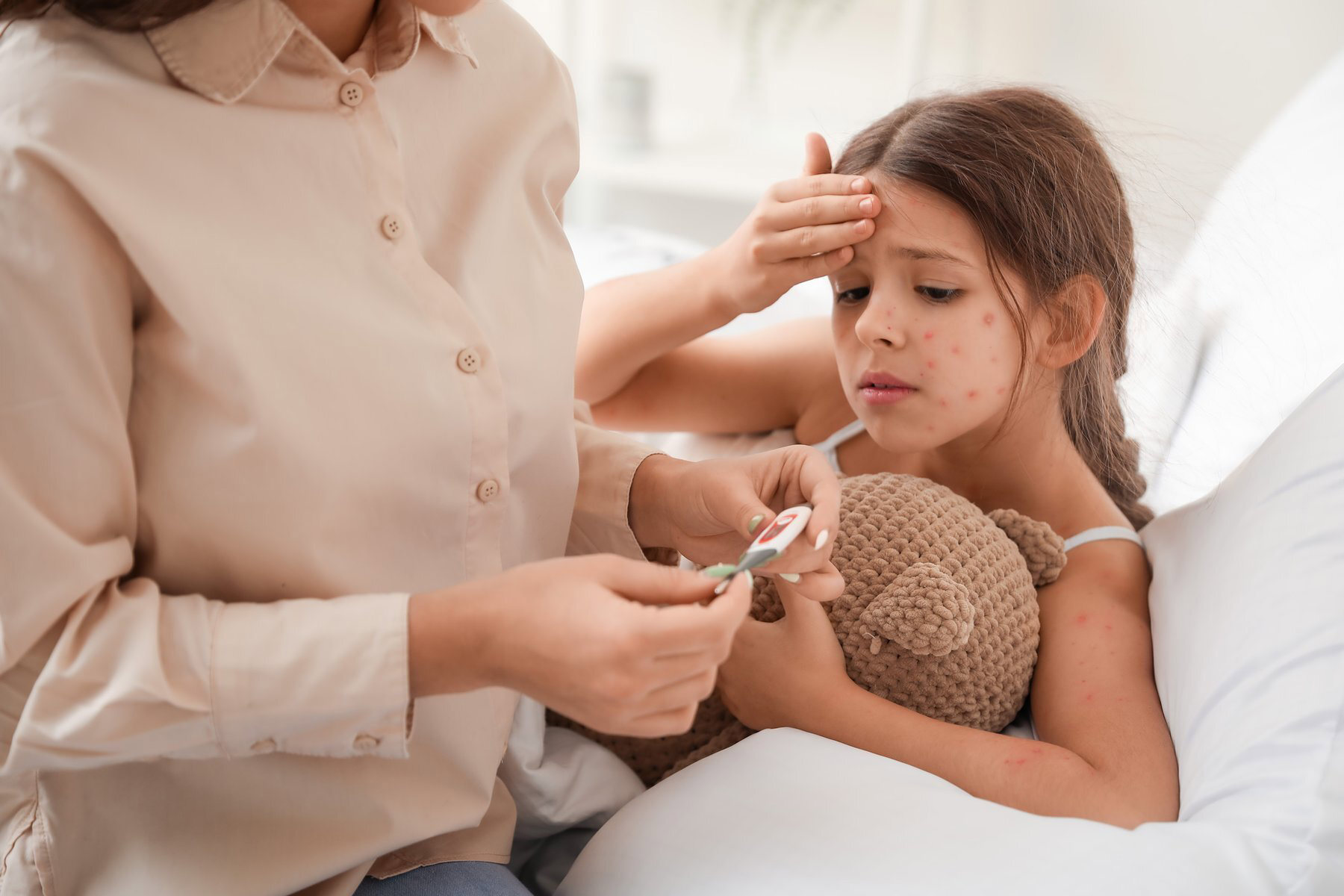 10 important facts you need to know about measles 10 important facts you need to know about measles