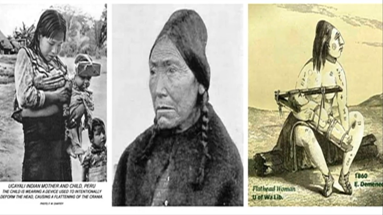 Elongated Skulls Of Peru Complete Analysis, DNA Results And Surprising ...