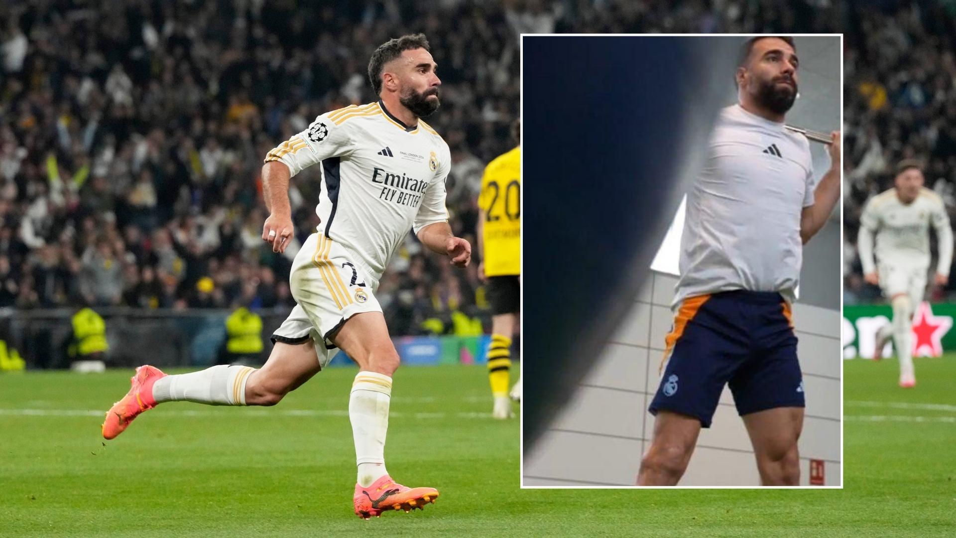 La foto viral de la diferencia entre las dos piernas de Dani Carvajal y ...