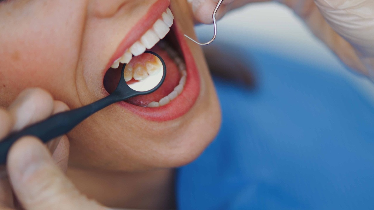 Delhi's new healthcare initiative: Free dental checkups at your doorstep