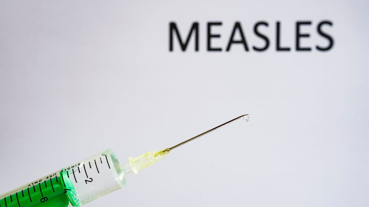 Texas measles outbreak 2025: Measles cases jump to 400