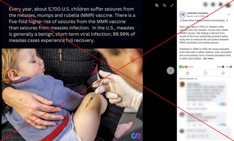 Measles seizure risks outweigh rare vaccine side effects