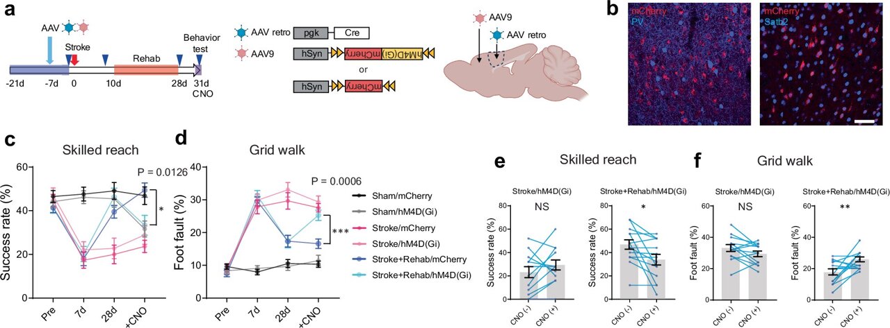 First stroke rehabilitation drug that reestablishes brain connections ...
