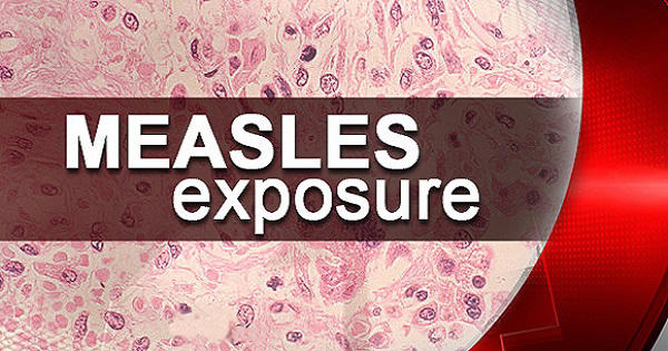 Measles Cases Confirmed in Prince George’s County