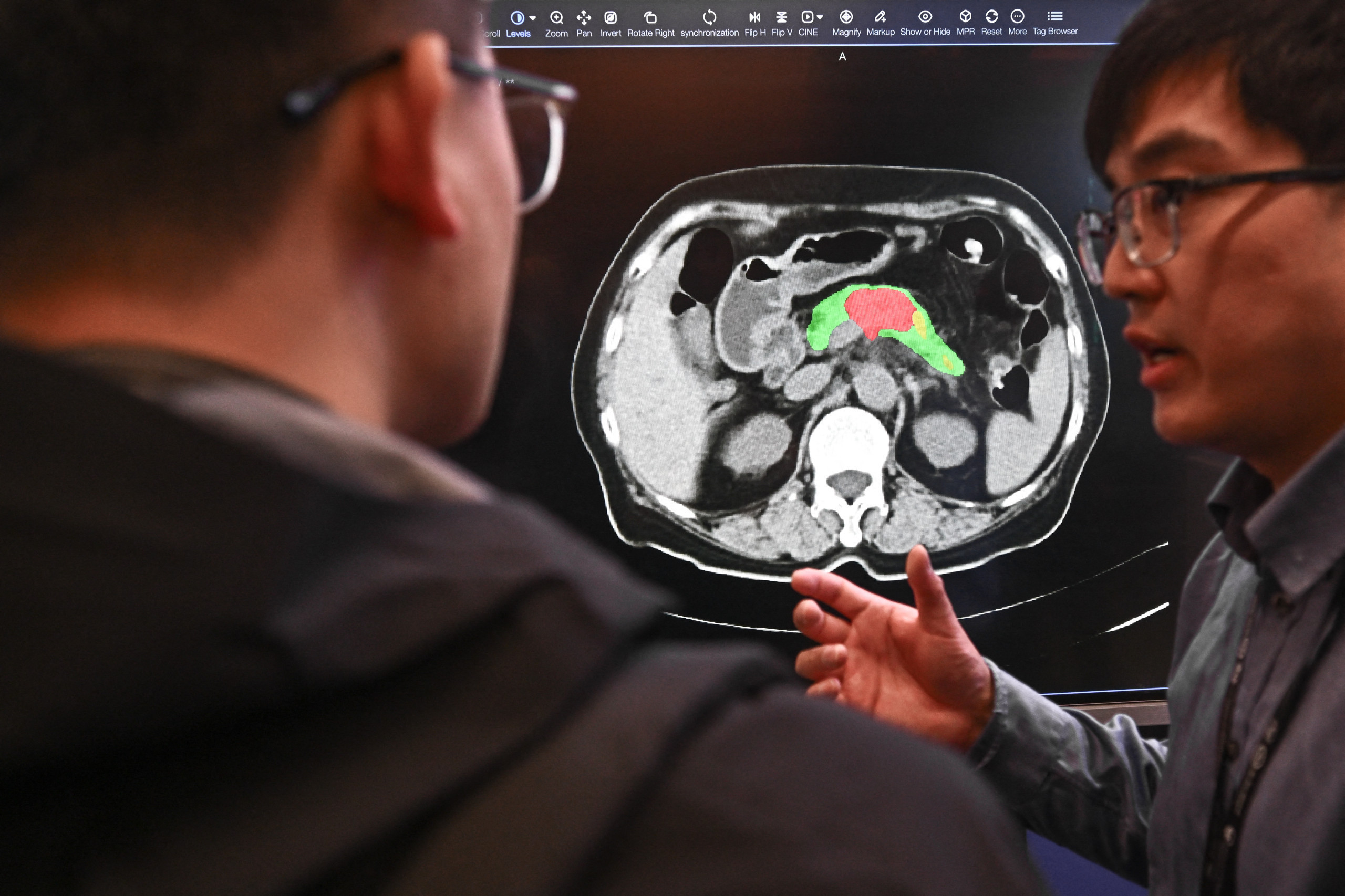 Have scientists found a way to erase bad memories?