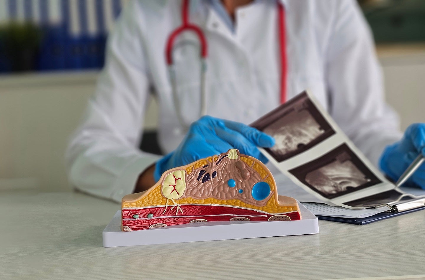 Lunit seeks FDA clearance for breast cancer risk prediction model