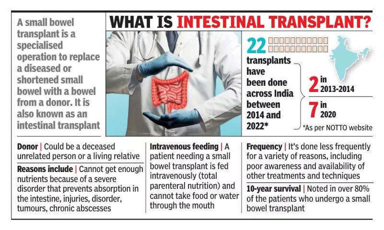 City’s 1st small bowel transplant of 2025 carried out