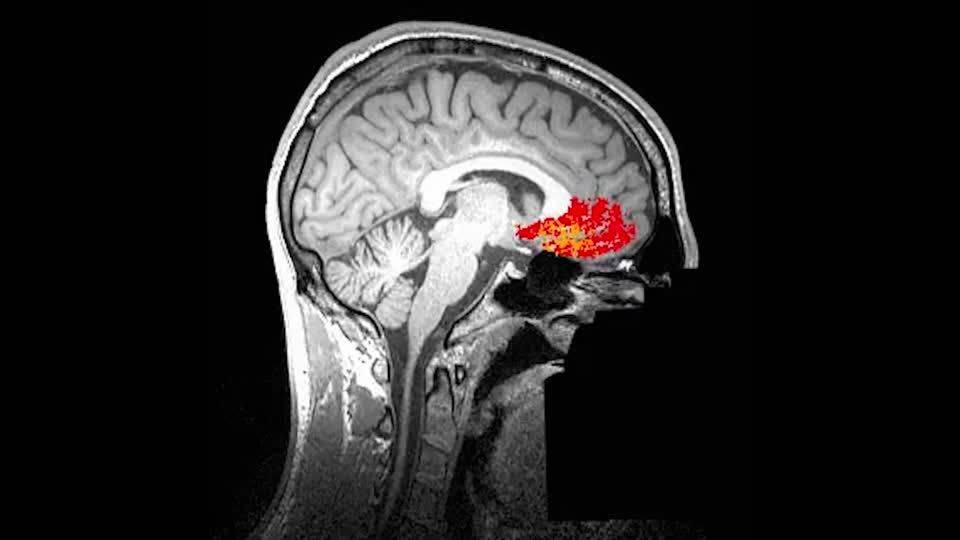 MELD Graph: como a inteligência artificial pode ajudar pessoas com ...