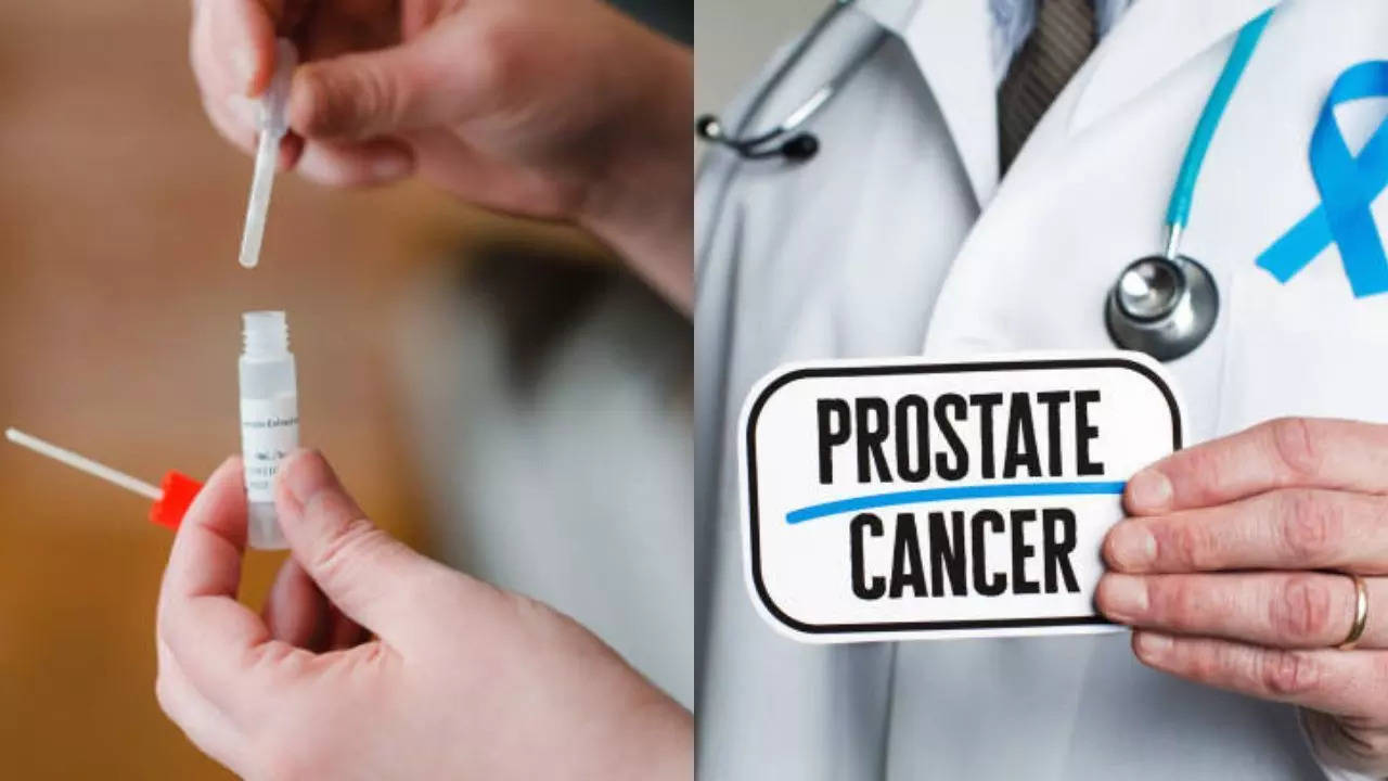 THIS Simple At-Home Test Can Help Diagnose Prostate Cancer, Is More ...