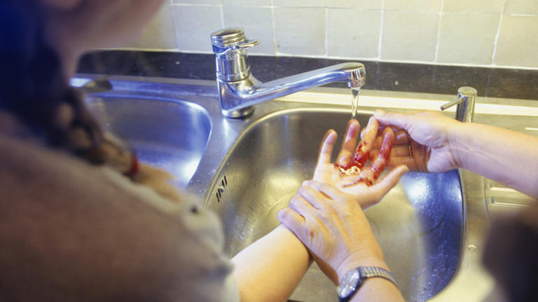 How To Build A First Aid Kit For Your Kitchen, According To A Chef