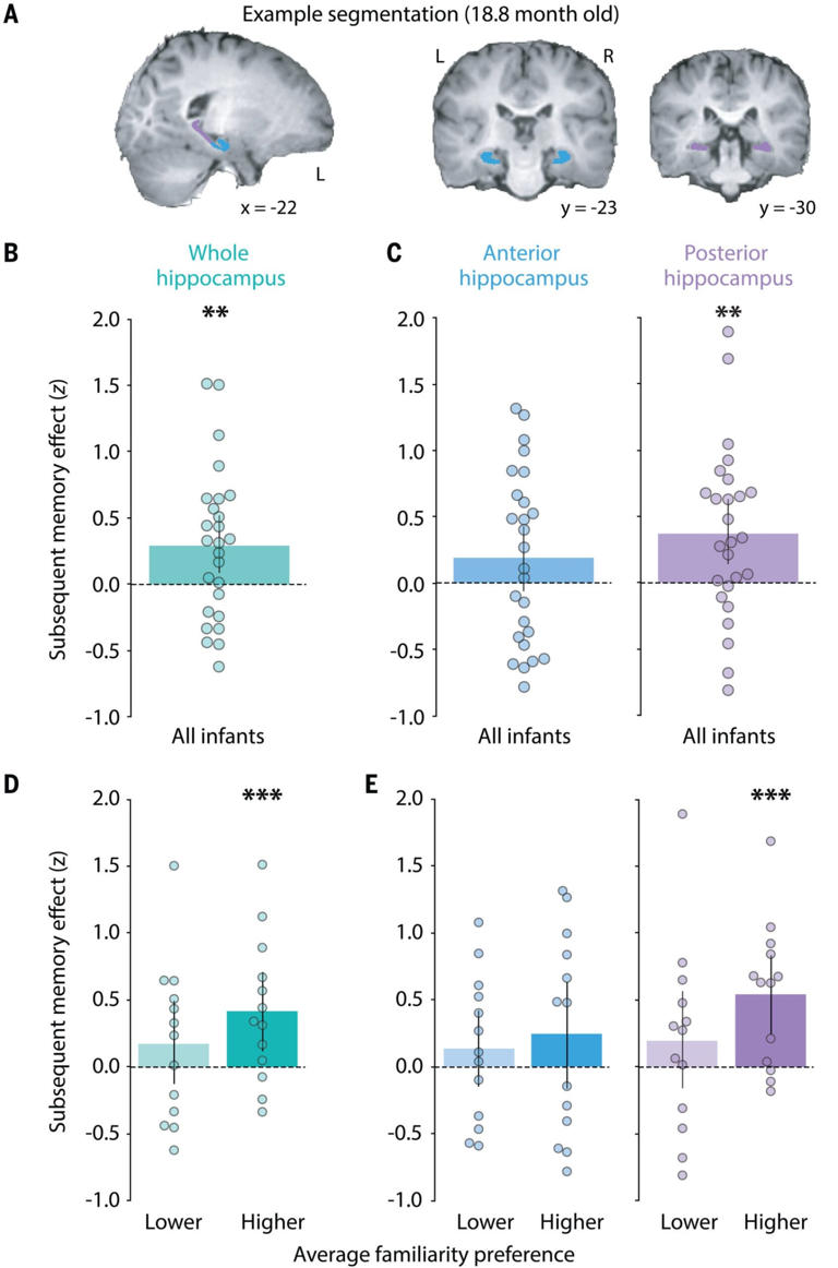 Researchers discover why people don’t remember being a baby