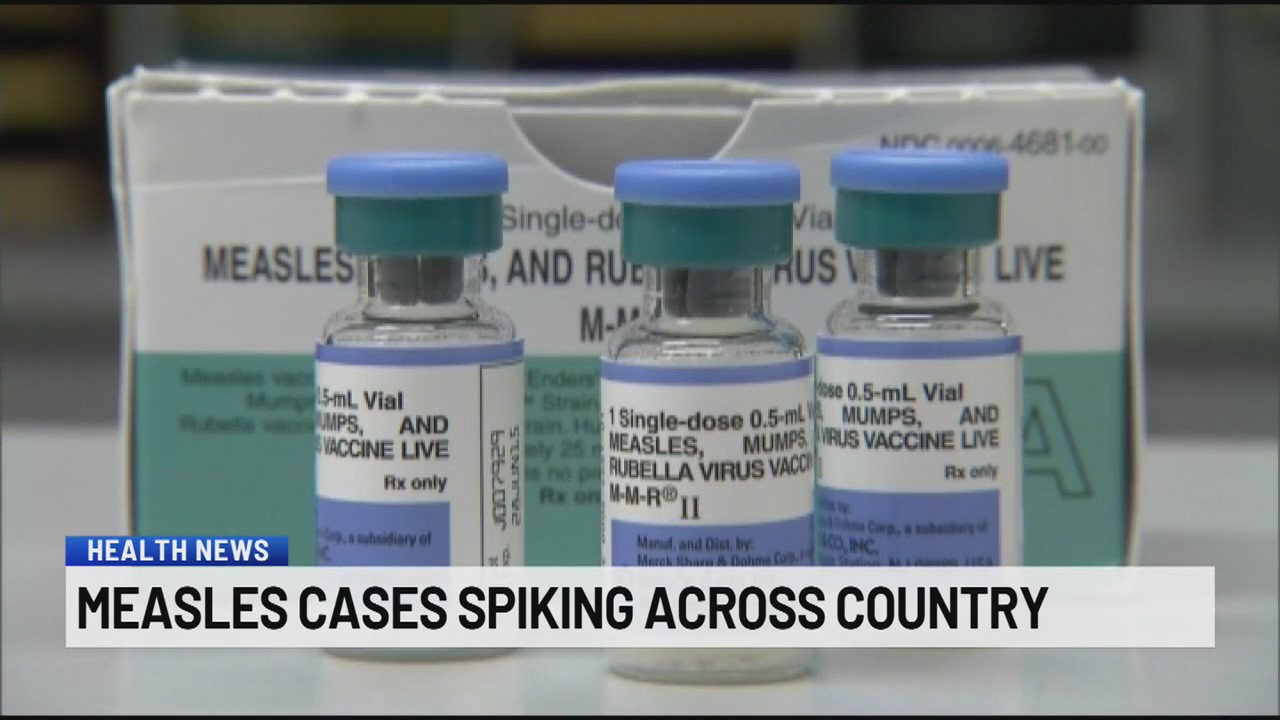 Measles cases spiking across country
