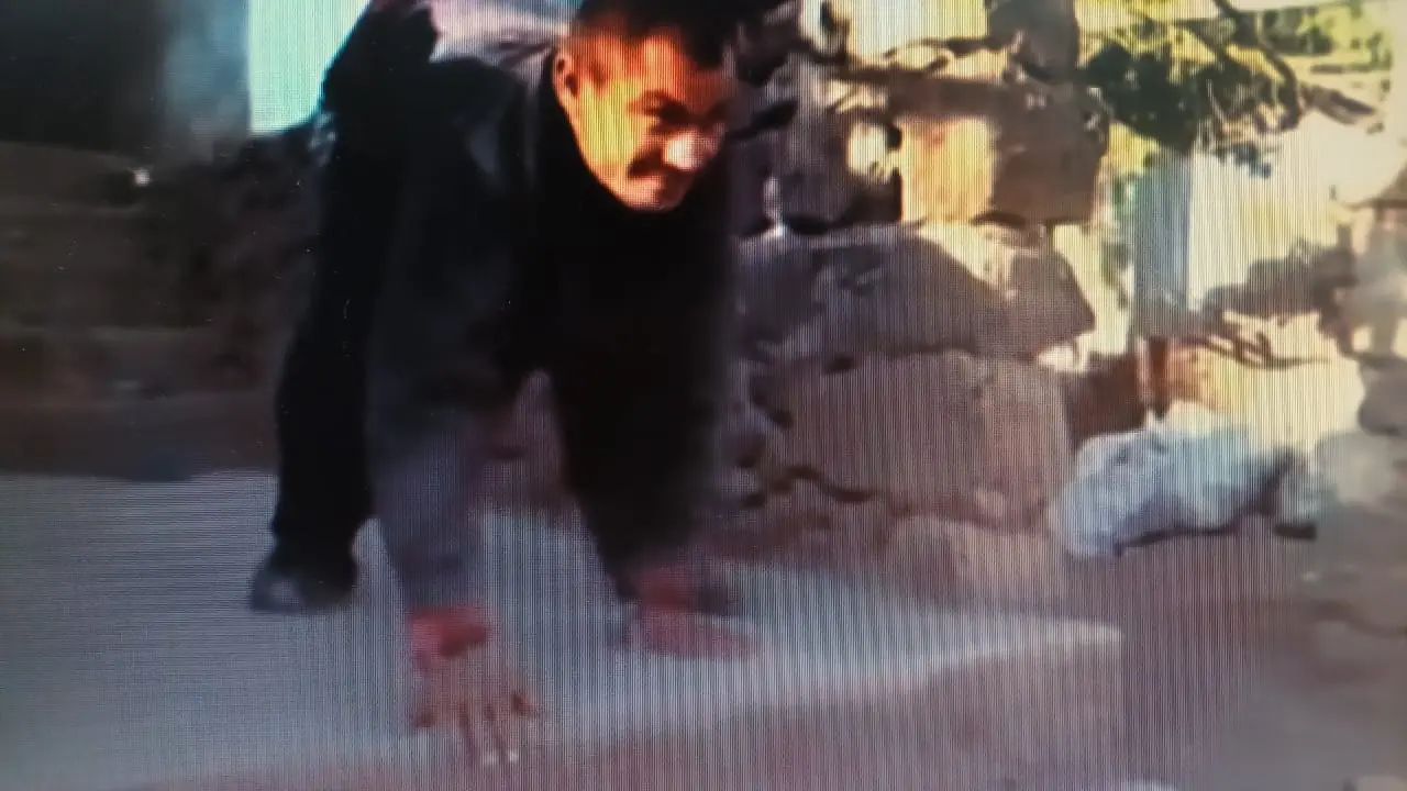 En cuatro patas: así caminan los miembros de una familia en Turquía