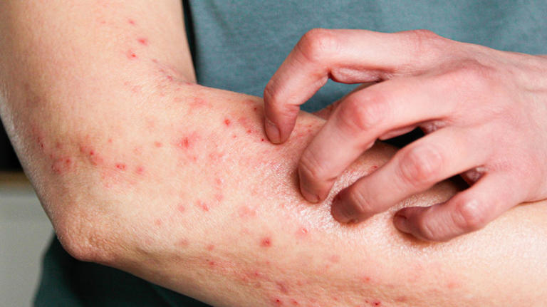 The 10 Most Unexpected Cholesterol Medication Side Effects