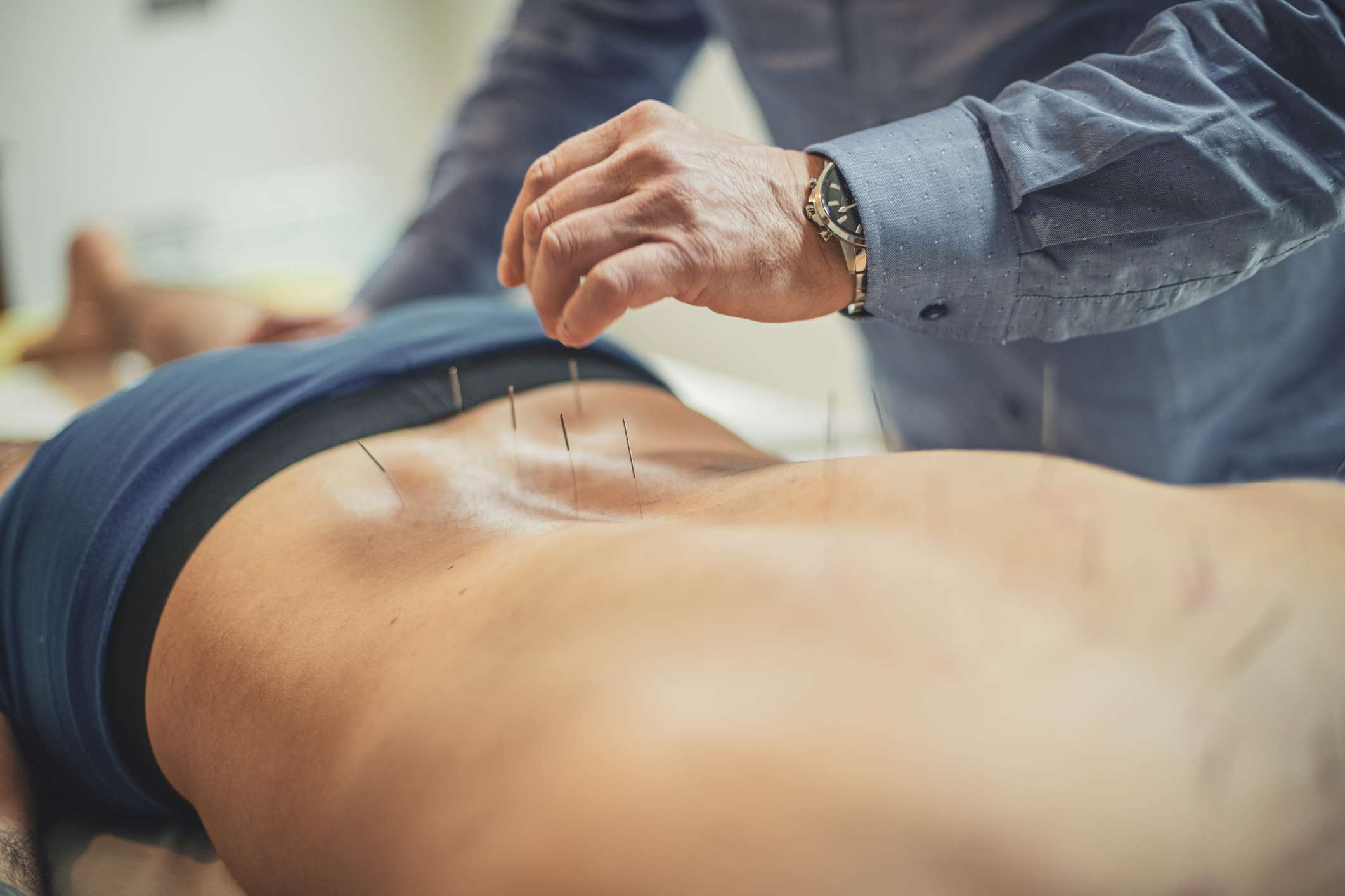Can Acupuncture Ease Your Back Pain? Benefits, Risks, and Treatment Options