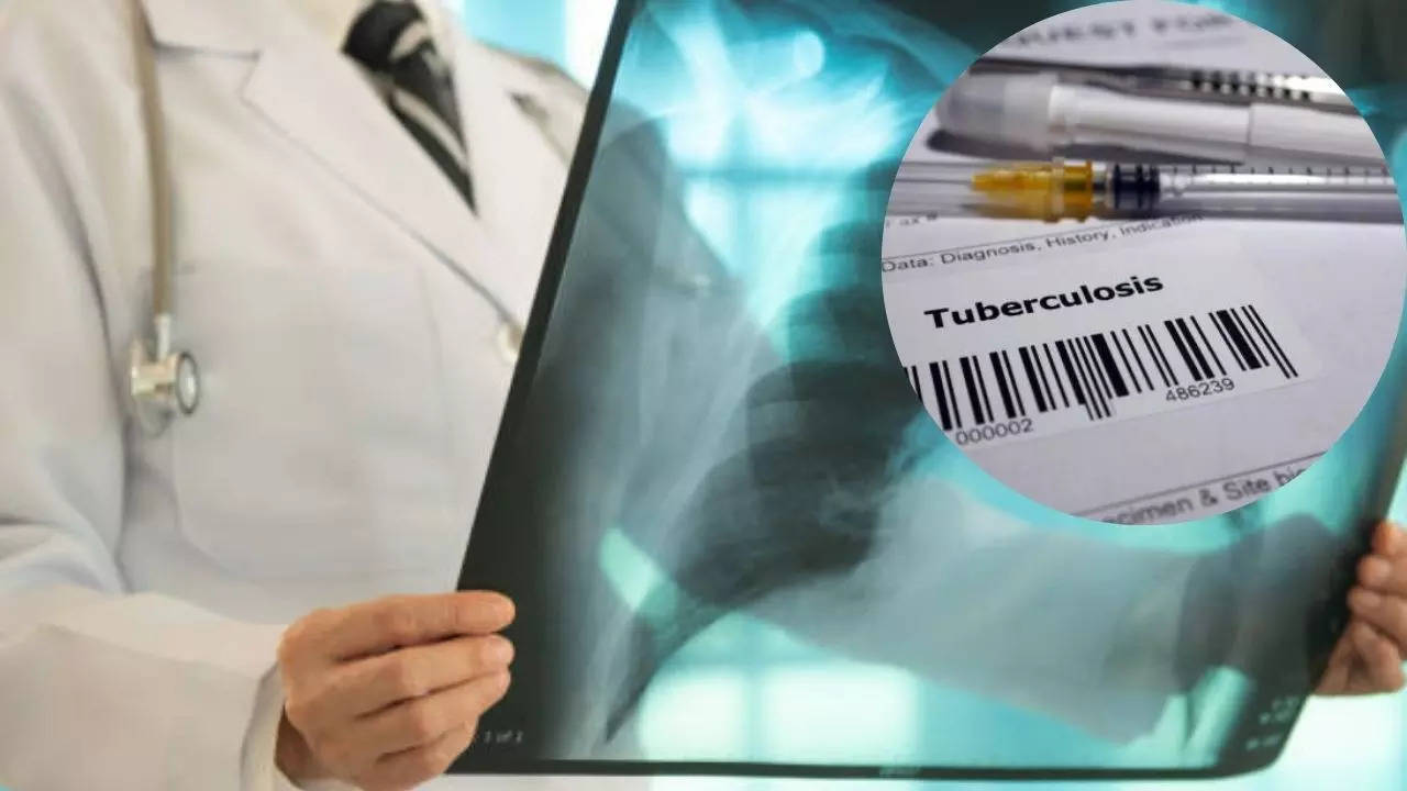 World TB Day: India Accounts For 30 Percent Global Cases; Why Are The ...