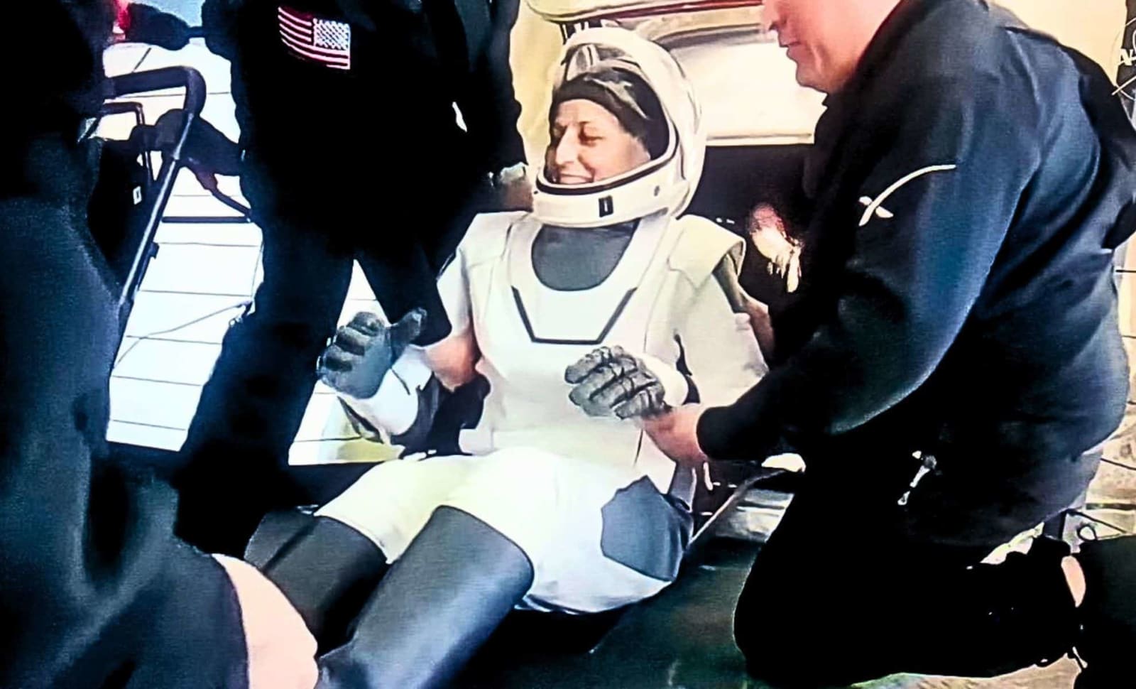 Before-and-After Photos Reveal Traumatic Physical Transformation of ...