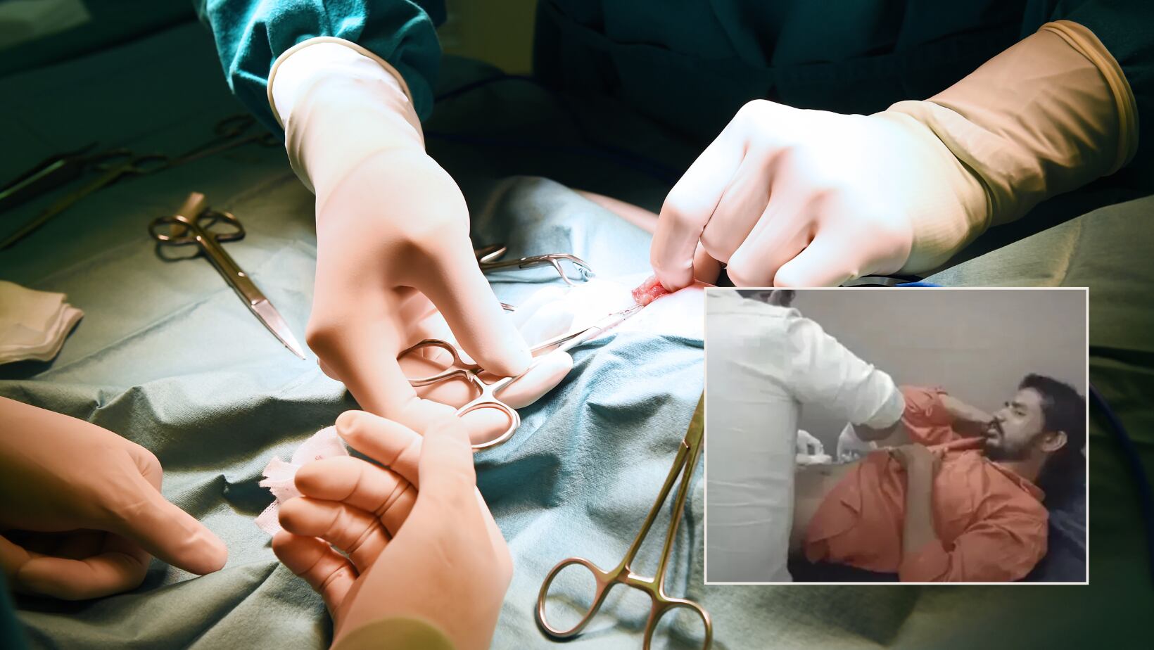 Hombre intenta operarse a sí mismo tras ver varios tutoriales en YouTube