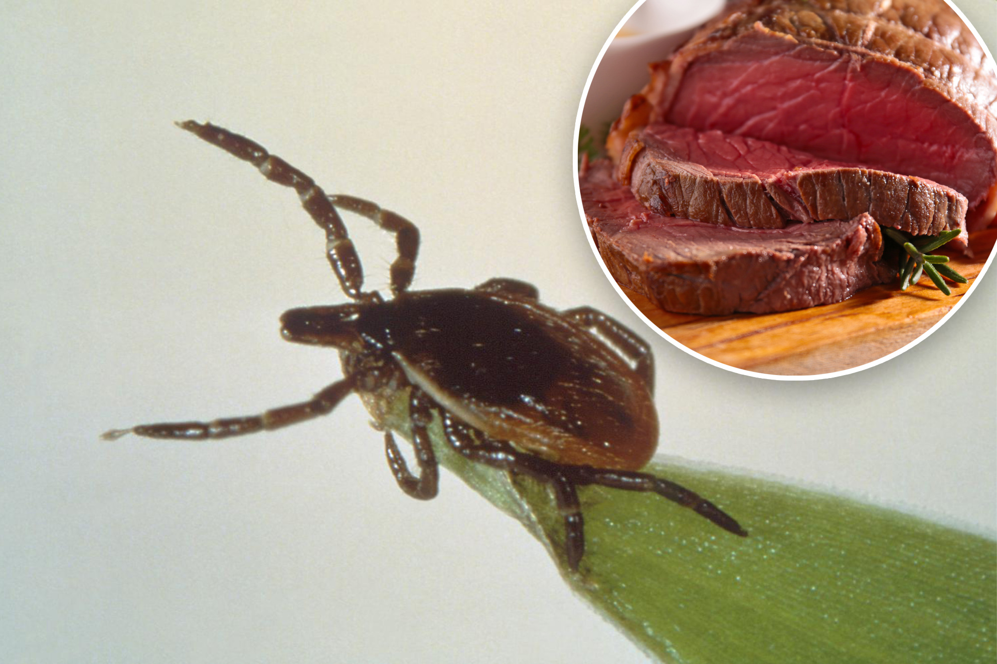 What is alpha-gal syndrome? New concern about bizarre red meat allergy ...