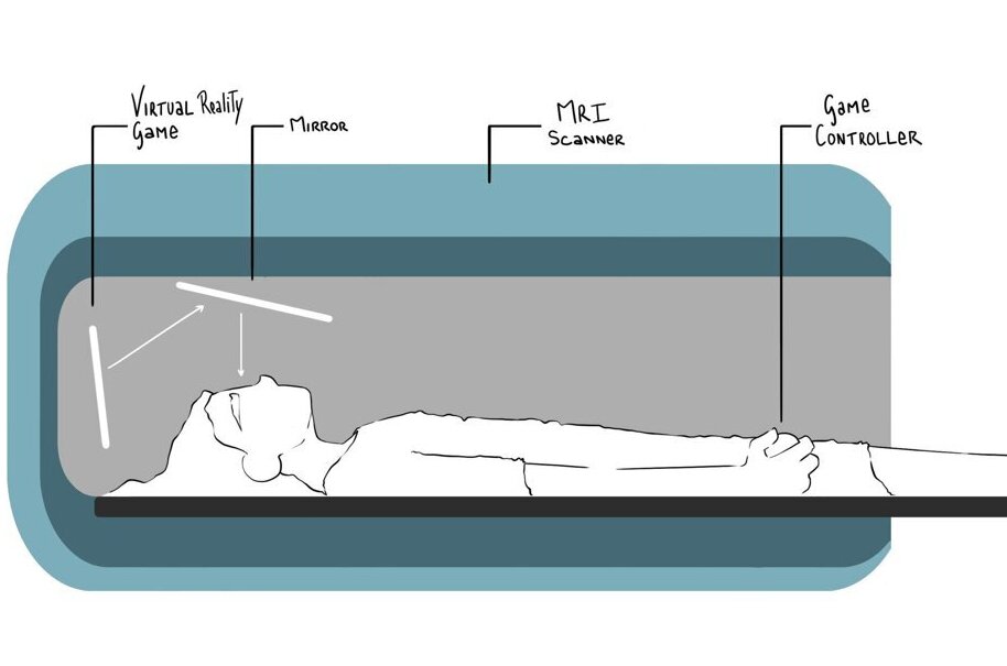 VR gaming scans reveal unique brain activity in children with ADHD