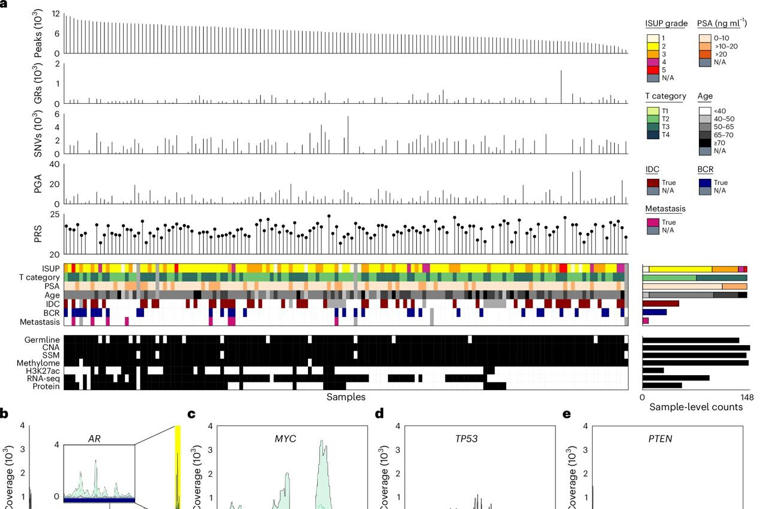 Study uncovers key role of RNA modifications in prostate cancer progression