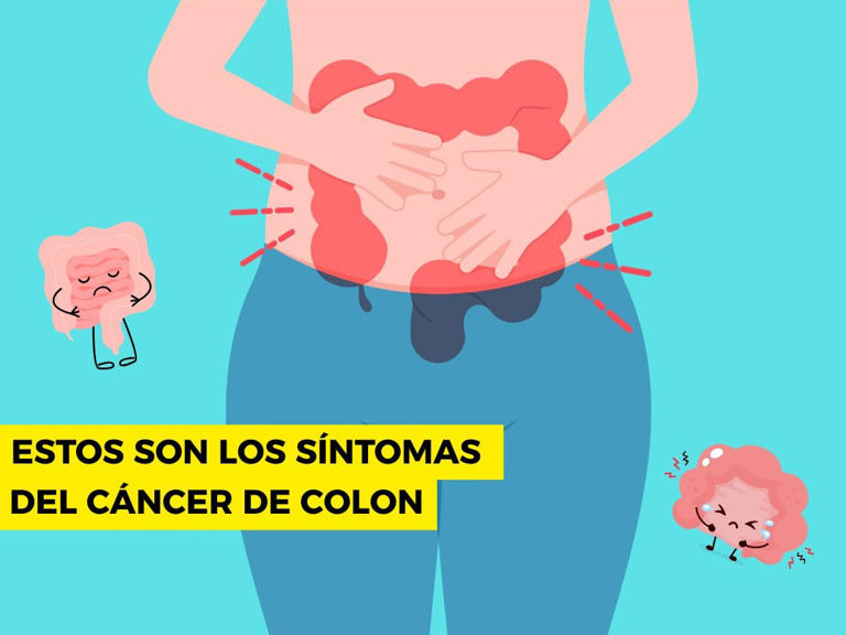 Síntomas de cáncer de colon similares a colon irritable: experto