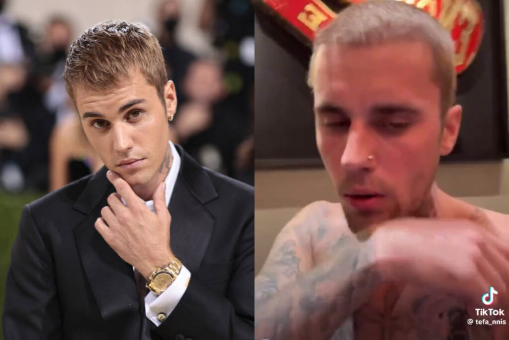 Justin Bieber Sparks Concern With Fans After Hopping On Live