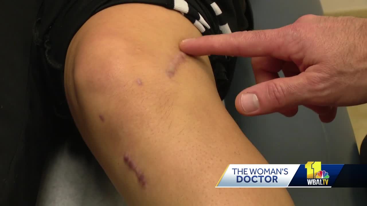 Woman's Doctor: LET procedure helps repair torn ACL