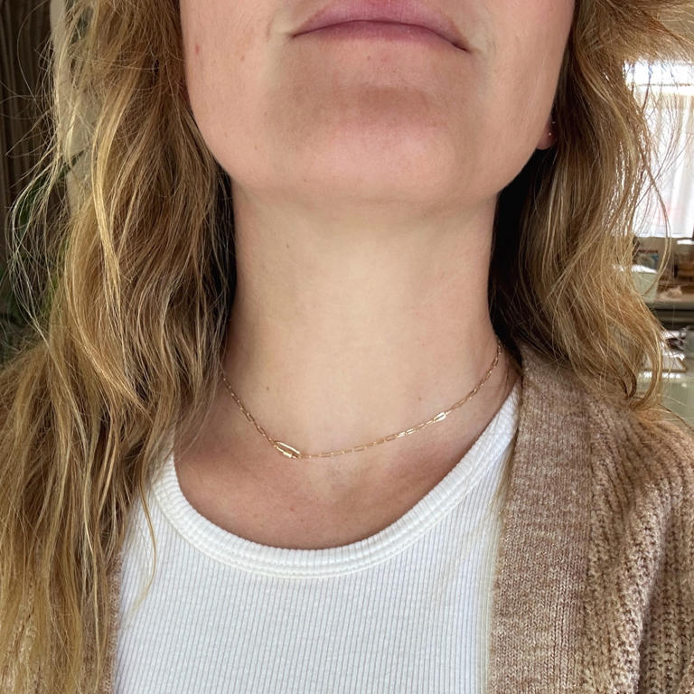 I Got Neck Botox to Treat My Tech Neck Wrinkles - and It Worked