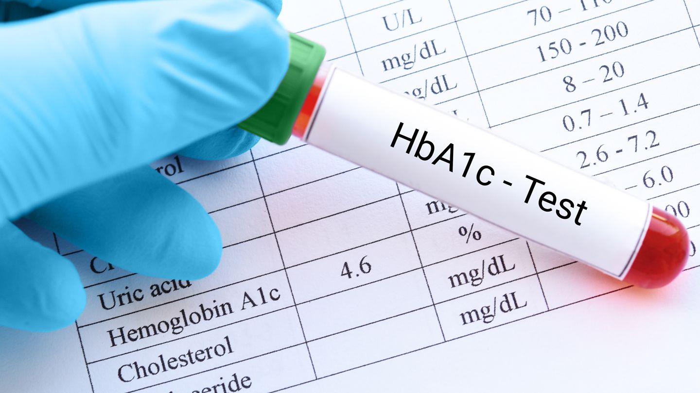 What Is the A1C Test for Diabetes?