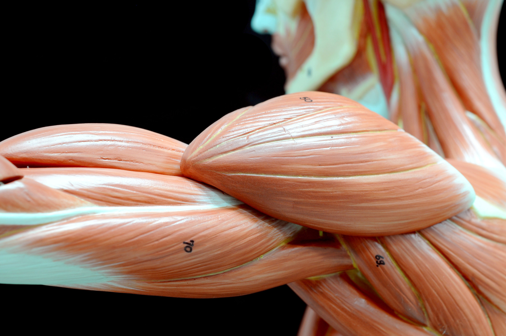 Diseases that mess with muscles