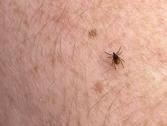 Blacklegged tick, two others can transmit alpha-gal syndrome. Can they ...