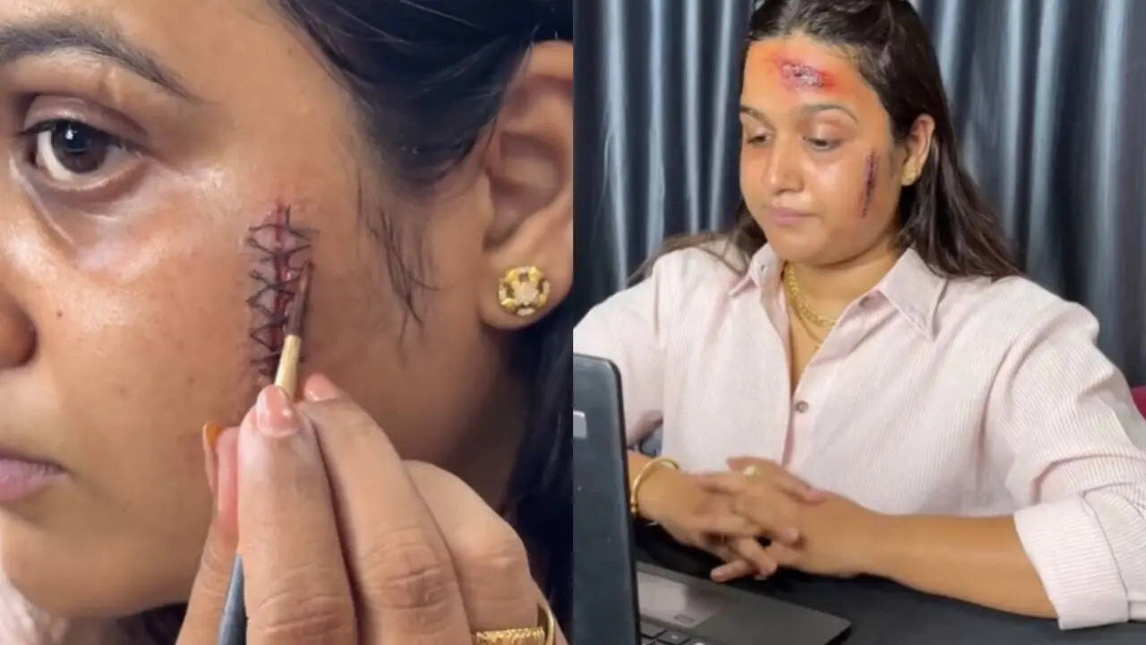Makeup Artist Shows 'How To Fake Injuries To Trick Your Boss For Time ...