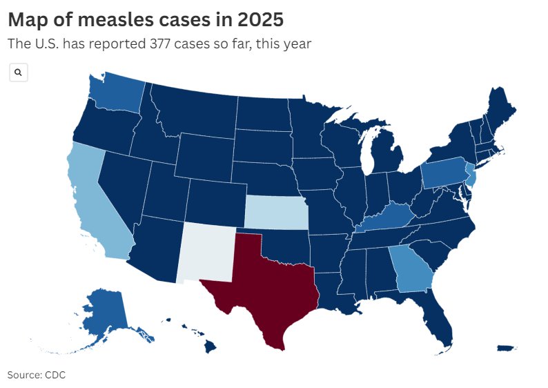 Map reveals where measles outbreaks are spreading across US states