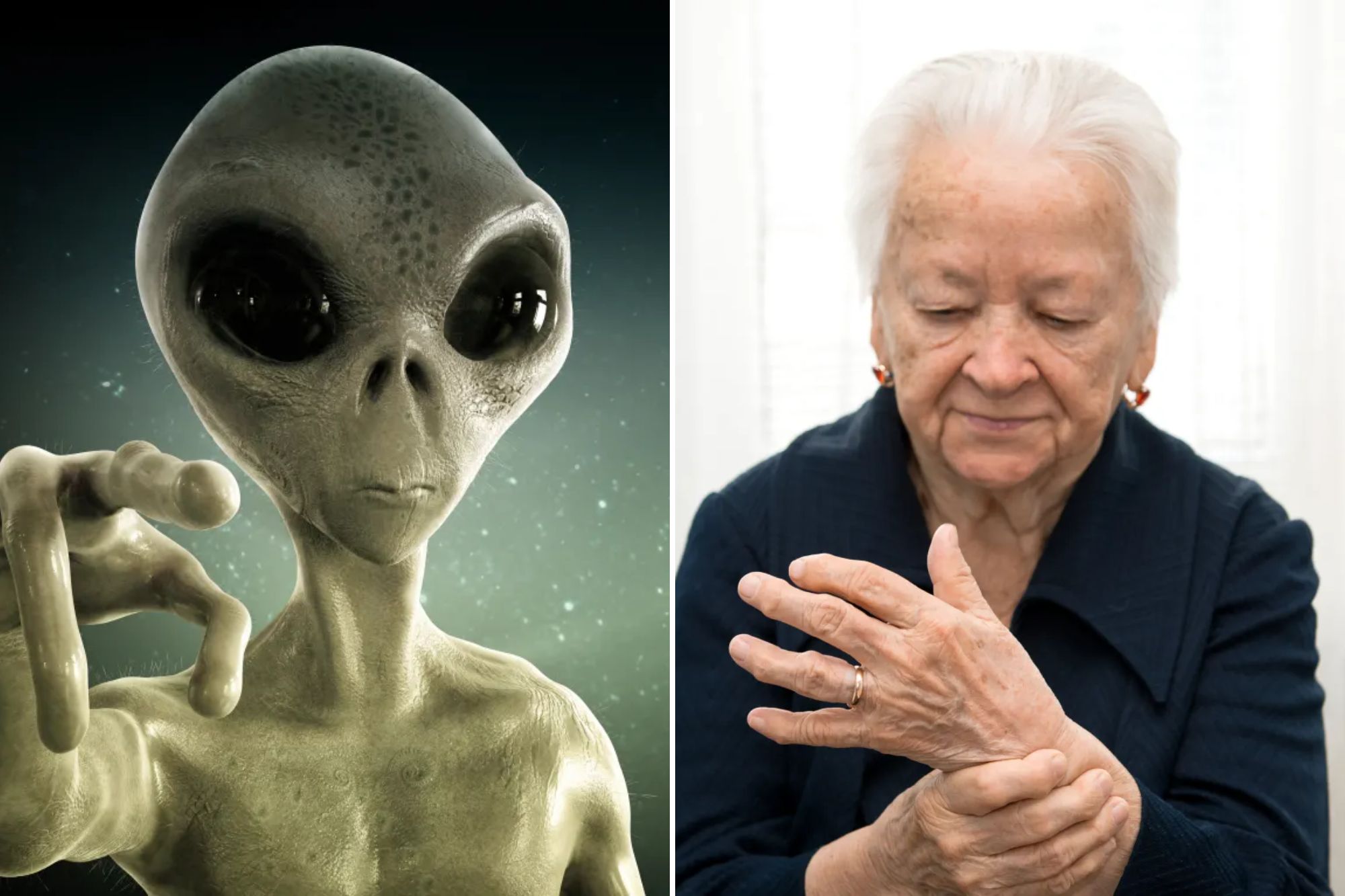 Elderly woman ‘terrified’ upon developing extremely rare ‘alien hand ...