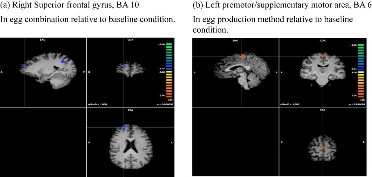 Can brain activity reveal your political party while grocery shopping?