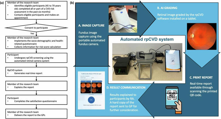 AI eye scans could help doctors identify heart disease and stroke risk