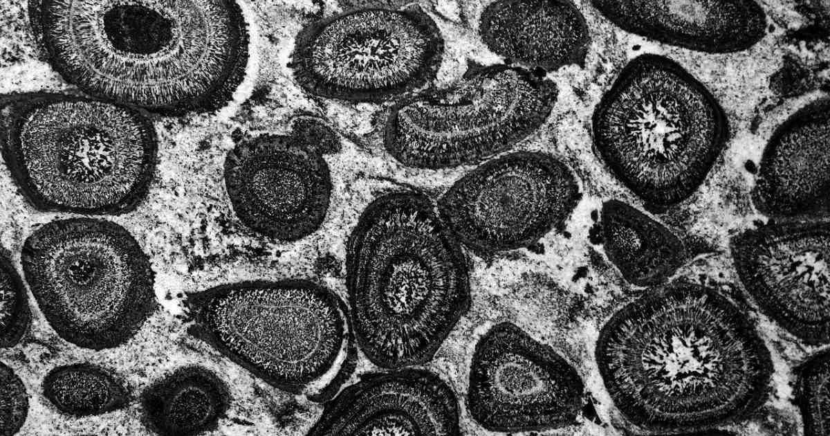 444-Million-Year-Old Exceptionally Rare Fossil Find Stuns Professor ...