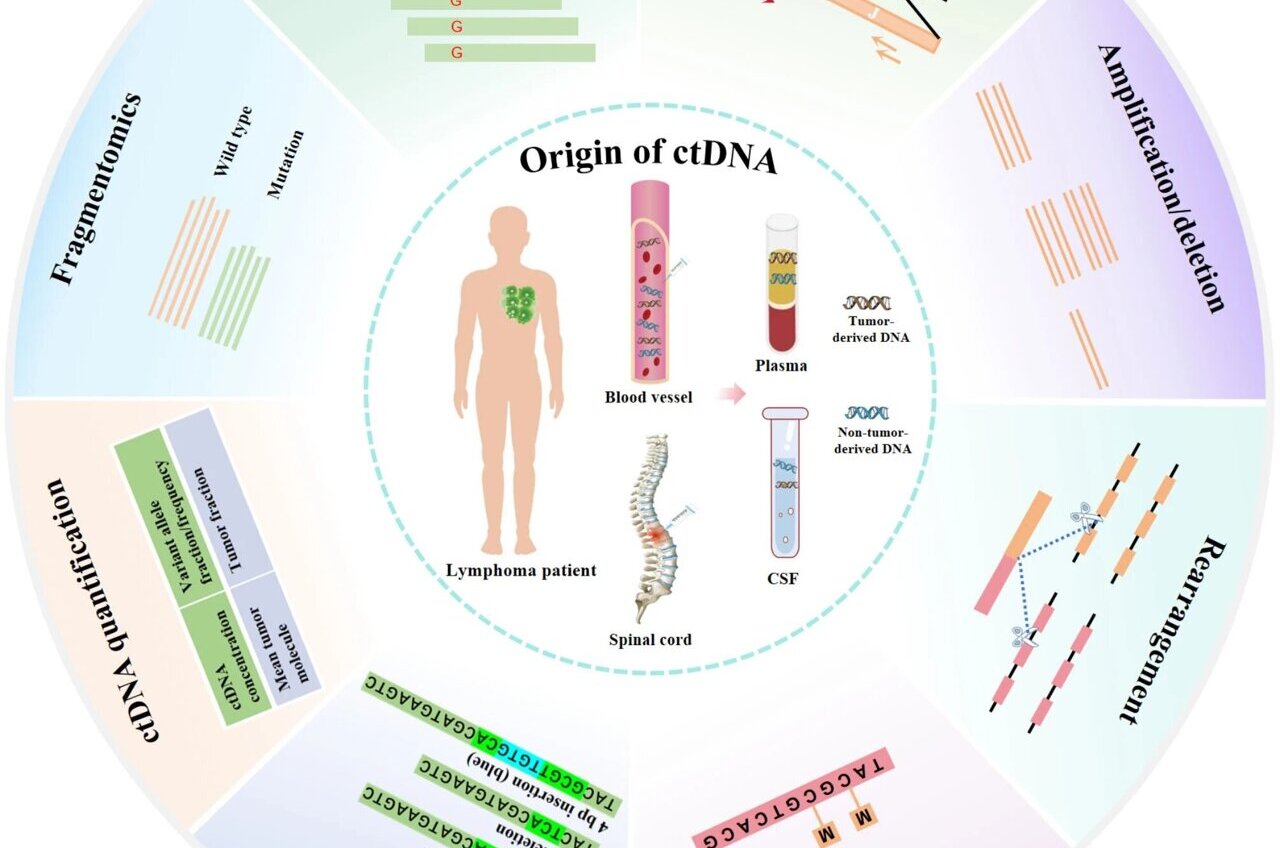 Advancements in ctDNA detection promise improved lymphoma outcomes