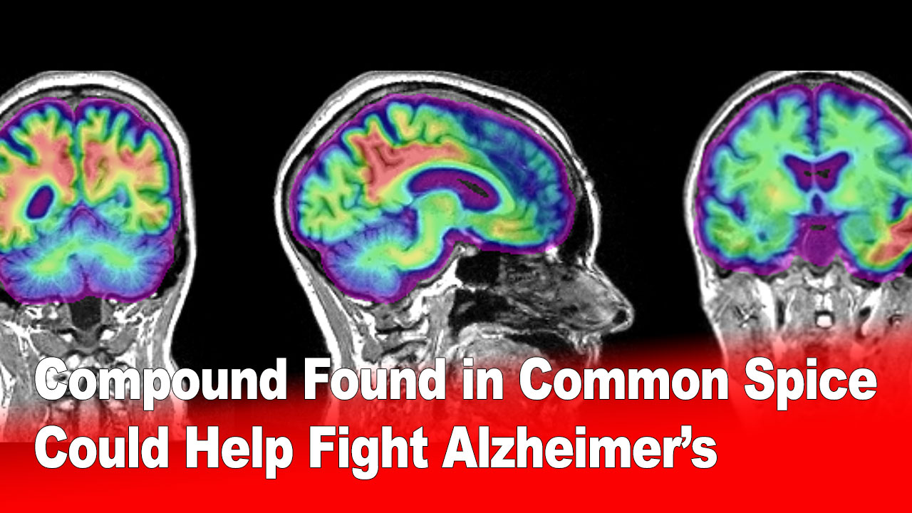 Compound Found in Common Spice Could Help Fight Alzheimer's